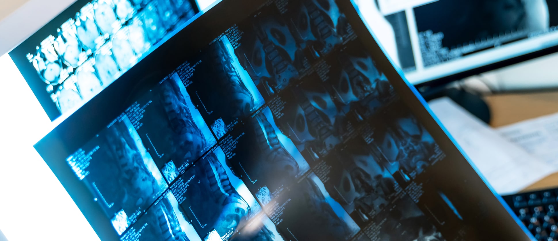 Big Data-powered radiology imaging software | Light IT